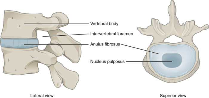 Annular Tear Pain in the Back | AllSpine